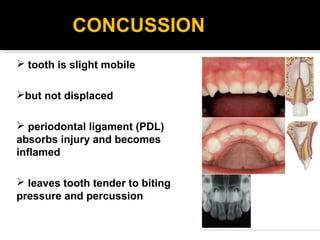 Management of displaced tooth | PPT