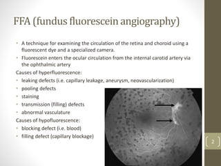 Management of dr | PPTX