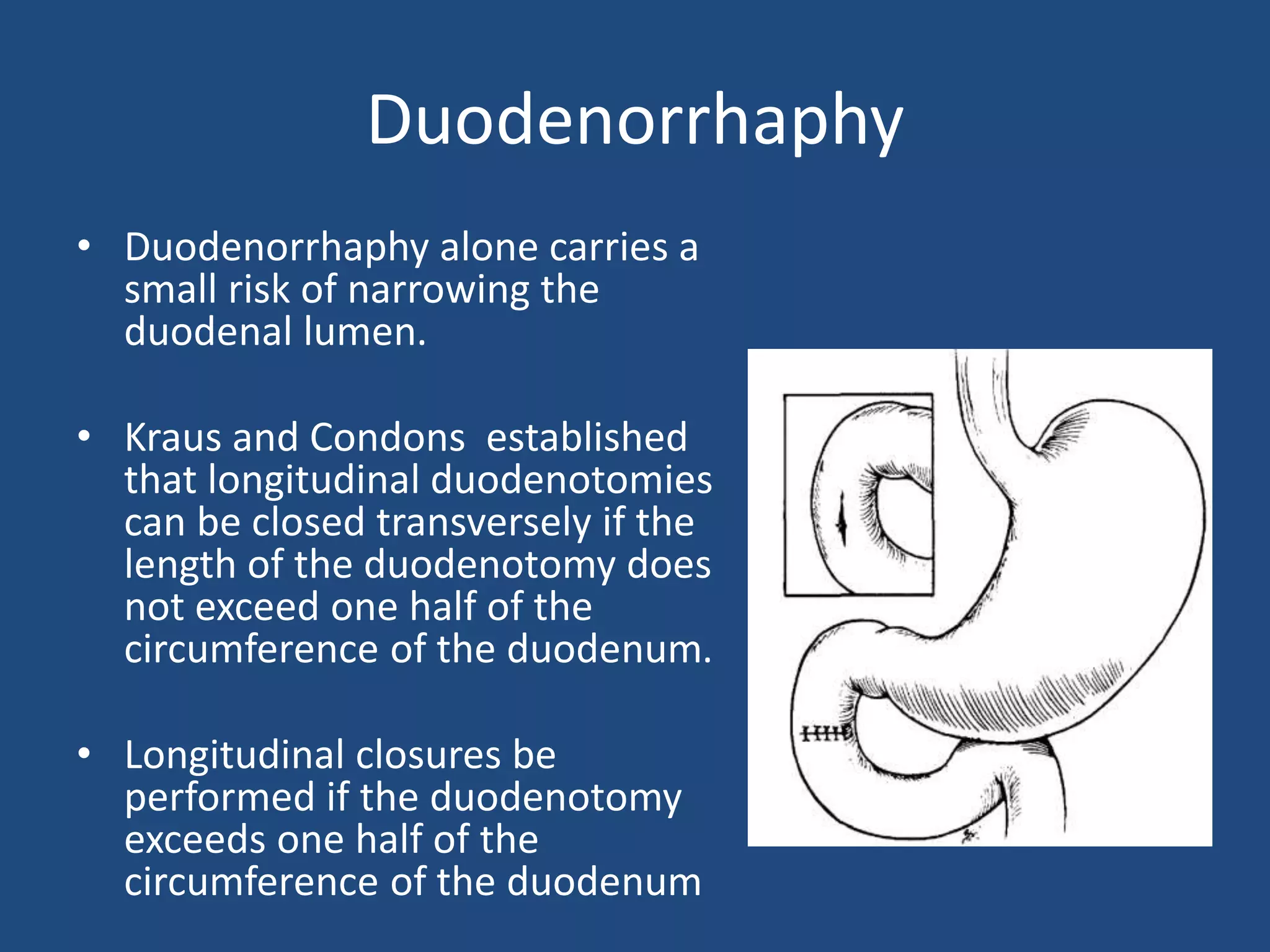 Management of duodenal trauma | PPTX