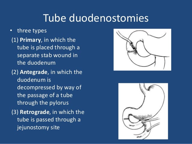 Management of duodenal trauma