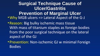 Understanding, Prevention & Treatment Of Symptomatic Bile Reflux | PPT