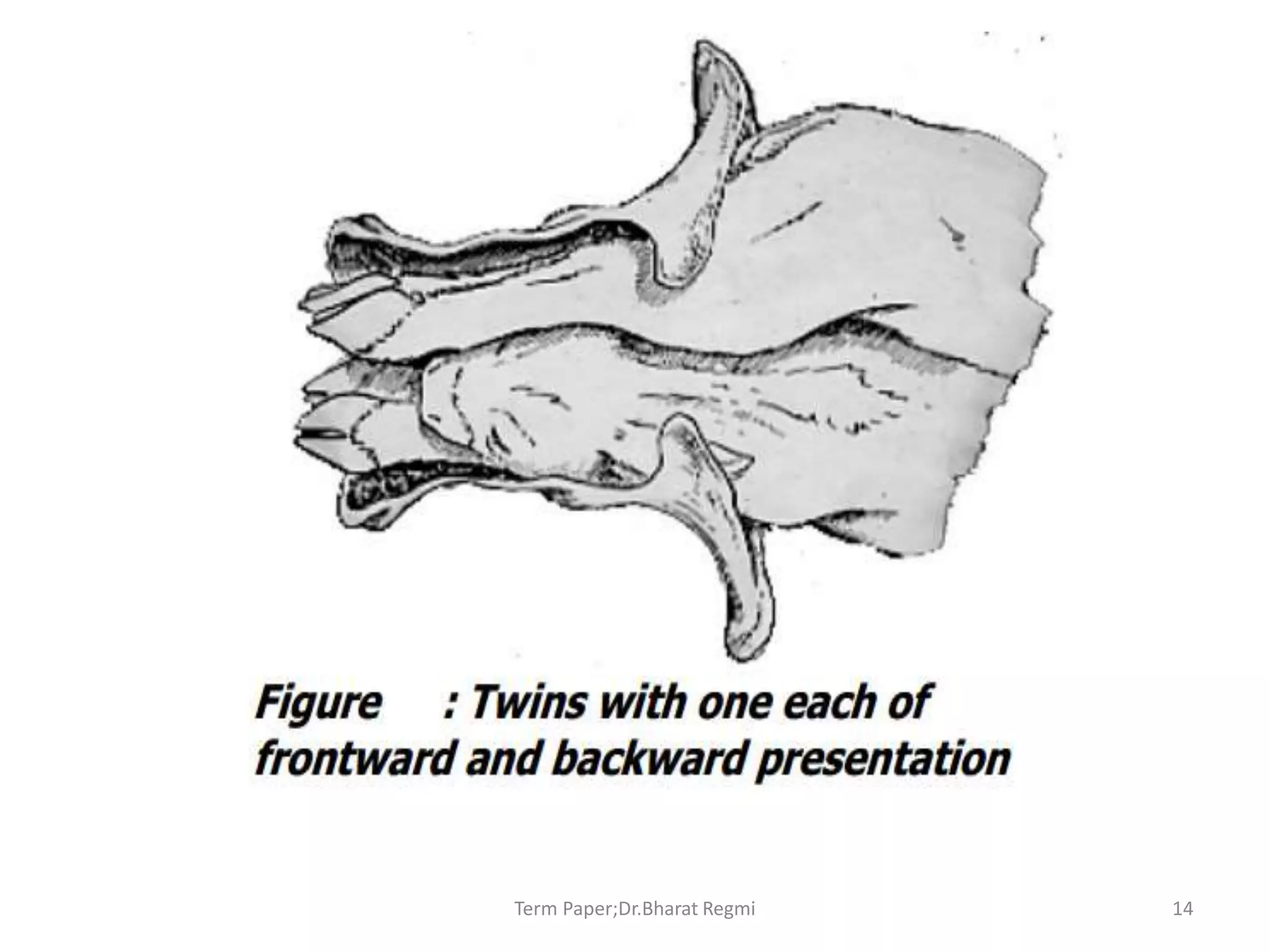 Management of dystocia in bovines | PPTX