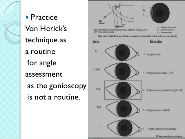 Management of early glaucoma: Evidence based medicine