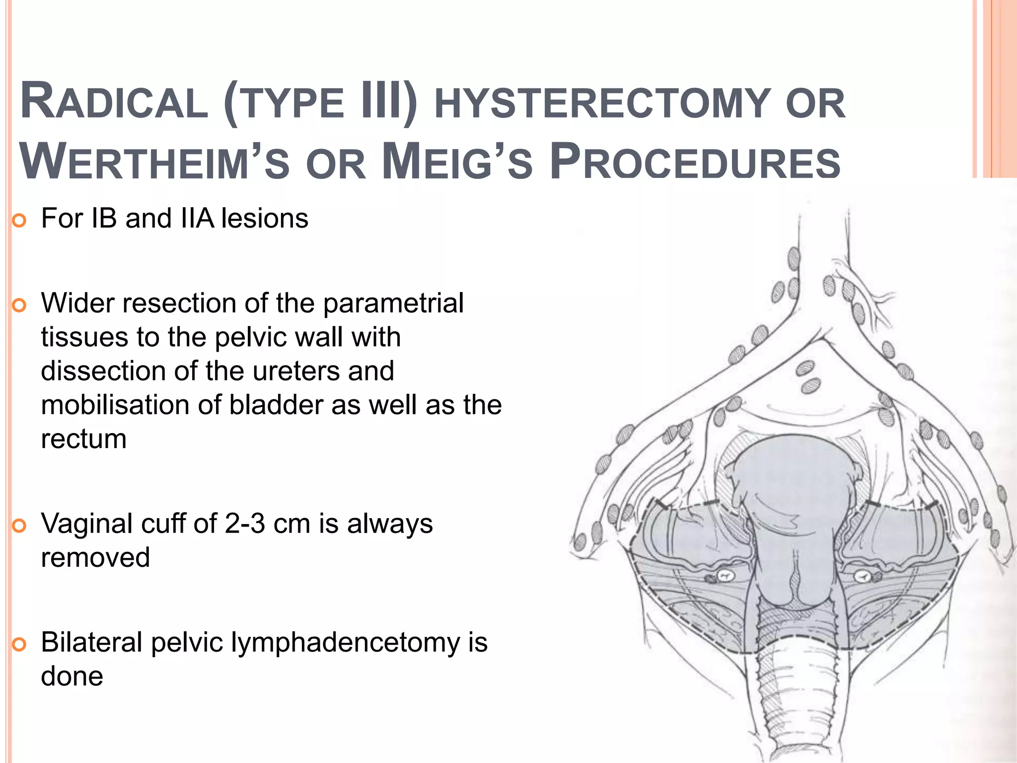 Management of Early Stage Carcinoma Cervix | PPTX