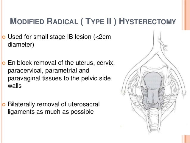 Management of Early Stage Carcinoma Cervix