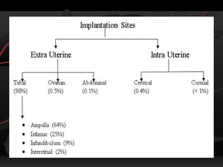 Management of ectopic pregnancy | PPT