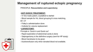Management of ectopic pregnancy. | PPTX