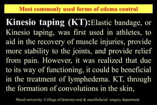 Management of edema in oral and maxillofacial surgery | PDF