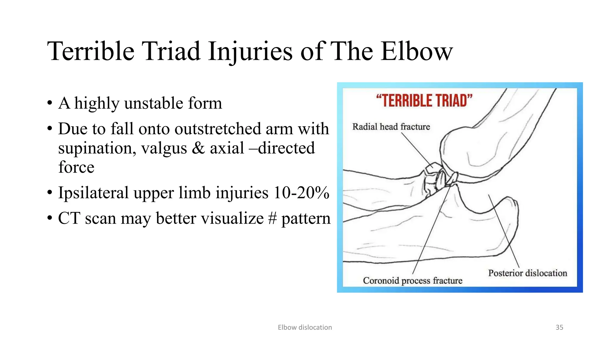 Management of Elbow Fracture Dislocation.pptx