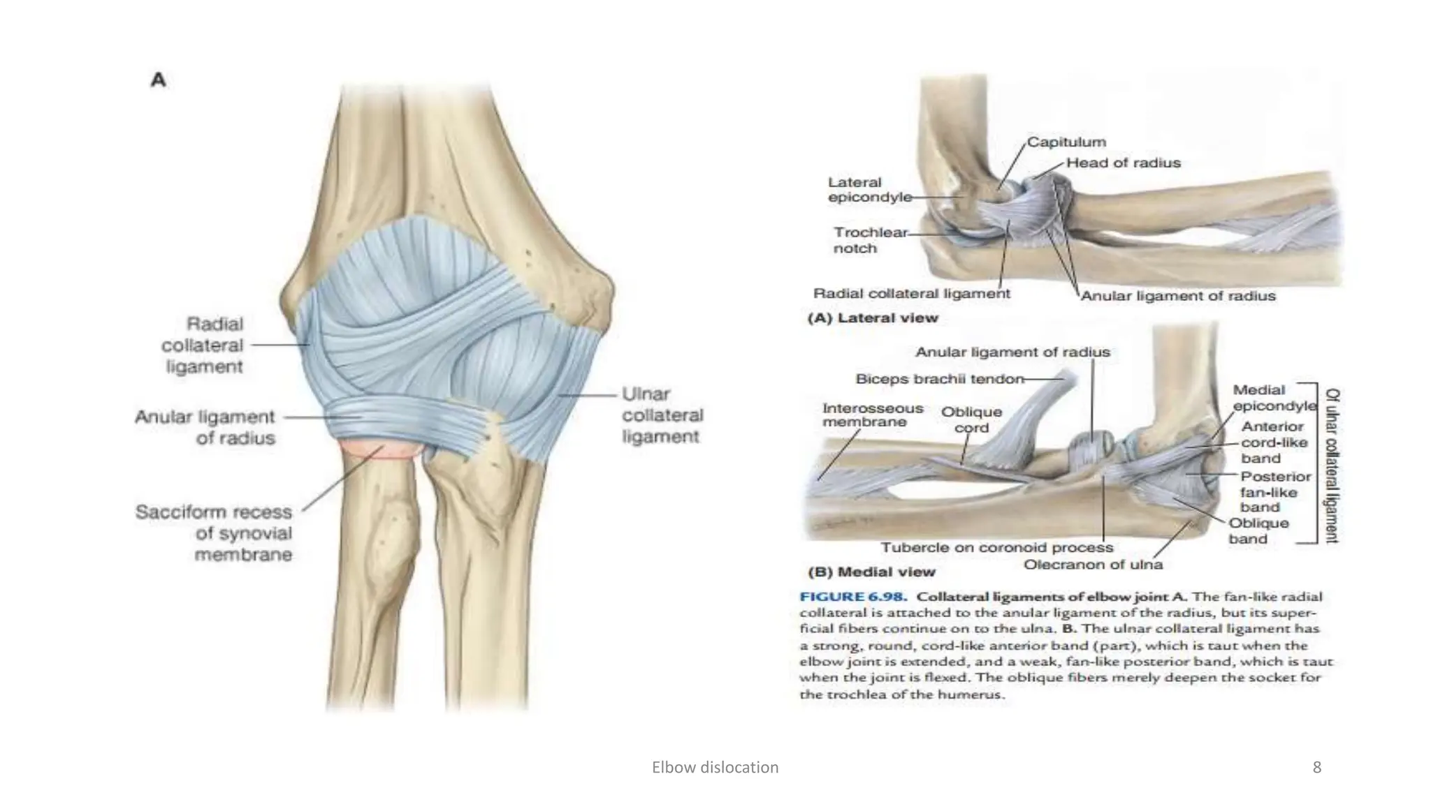 Management of Elbow Fracture Dislocation.pptx
