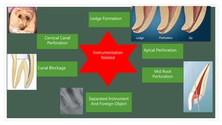 Management of endodontic mishaps seminar | PPTX