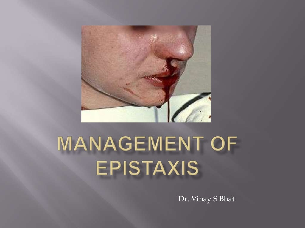 Management Of Epistaxis