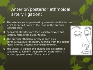 Management of epistaxis | PPTX