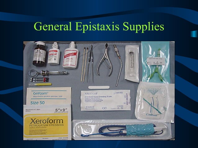 Management Of Epistaxis Goal Is Control | PPT