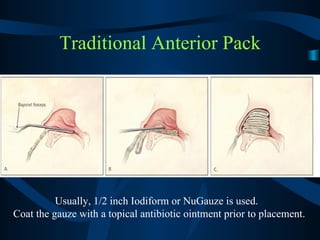 Management Of Epistaxis Goal Is Control | PPT
