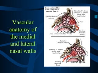 Management Of Epistaxis Goal Is Control | PPT