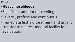 Management of epistaxis in primary care | PPTX