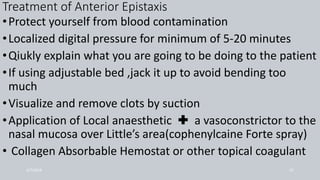 Management of epistaxis in primary care | PPTX