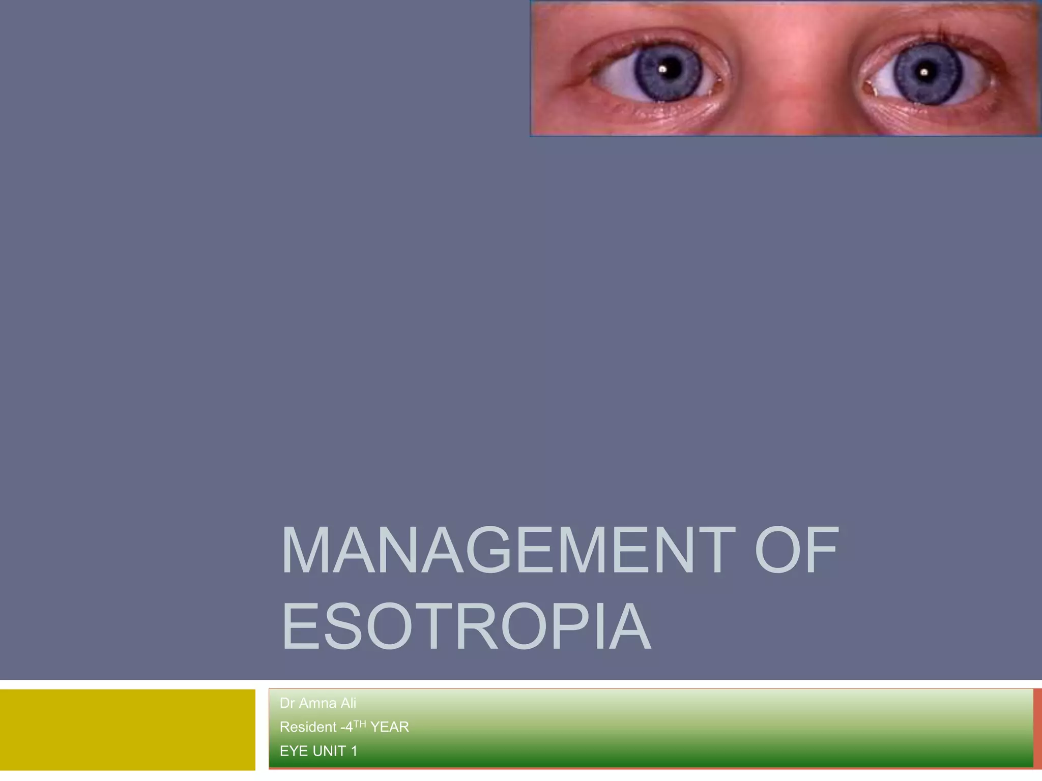 Management of esotropia.ppt
