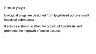 Management of fistula in ano recent advances | PPTX