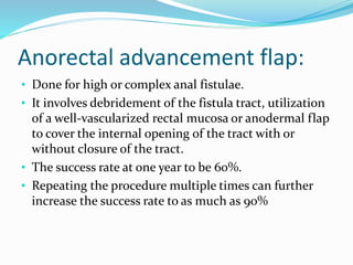 Management of fistula of ano. | PPTX