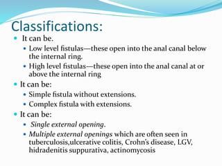 Management of fistula of ano. | PPTX