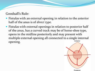 Management of fistula of ano. | PPTX