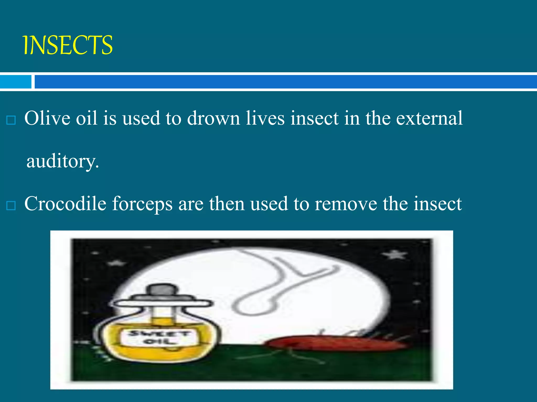 Management of foreign body in ear | PPTX