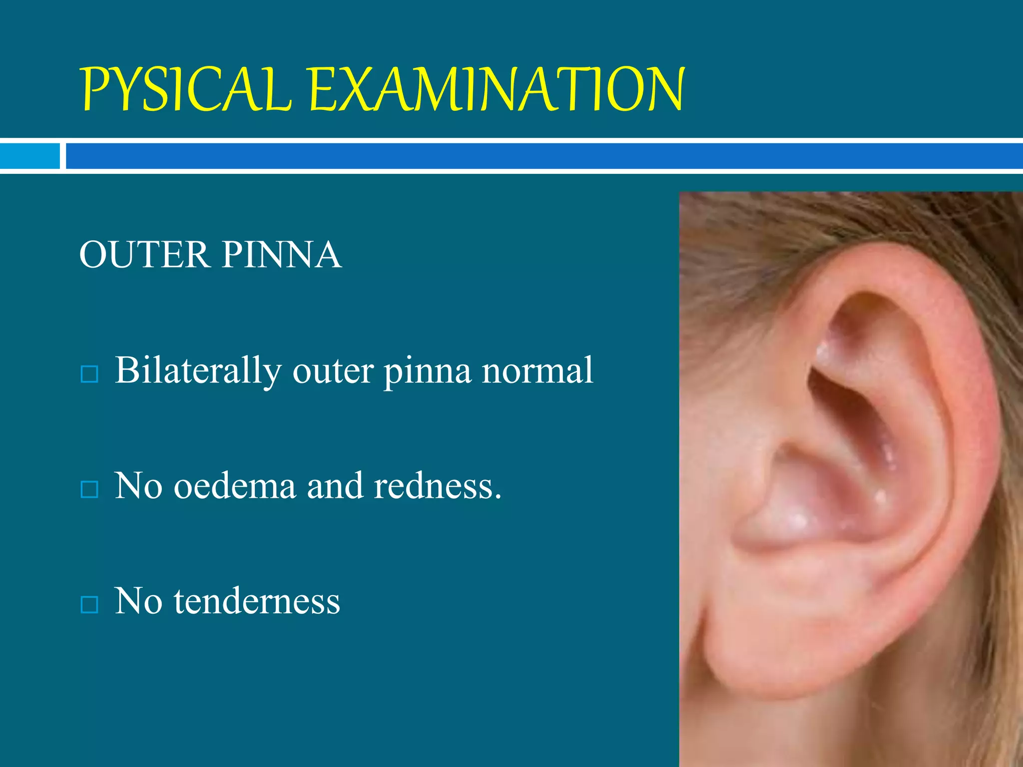 Management of foreign body in ear | PPTX