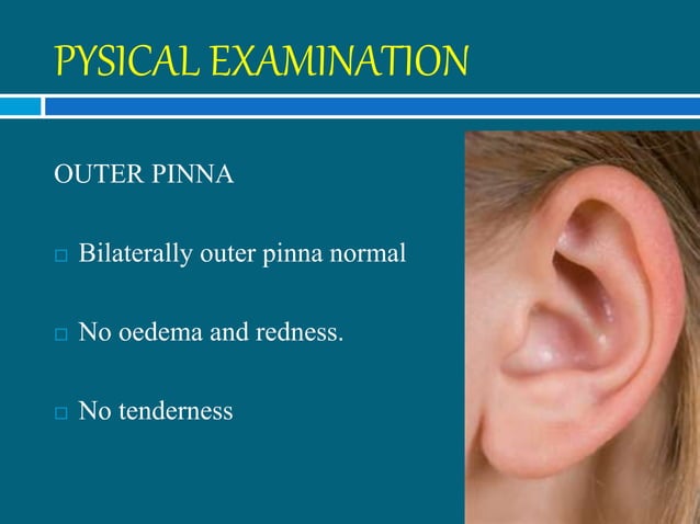 Management of foreign body in ear | PPTX