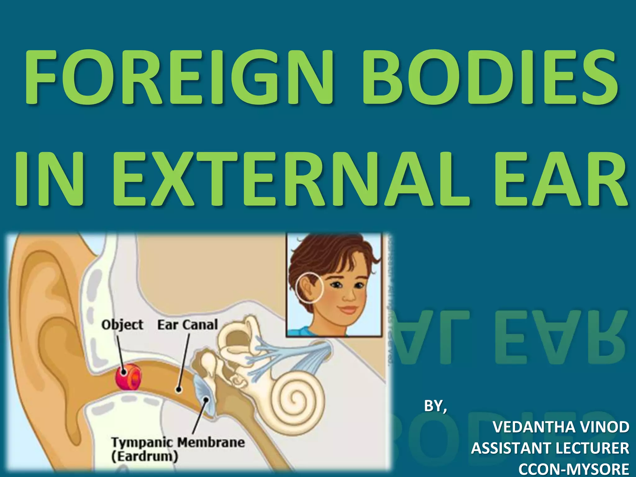 Management of foreignbody in ear | PPTX
