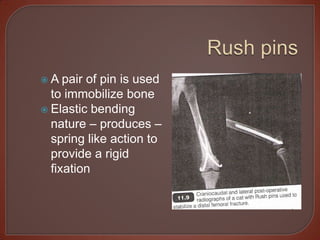 Management of fractures | PPTX