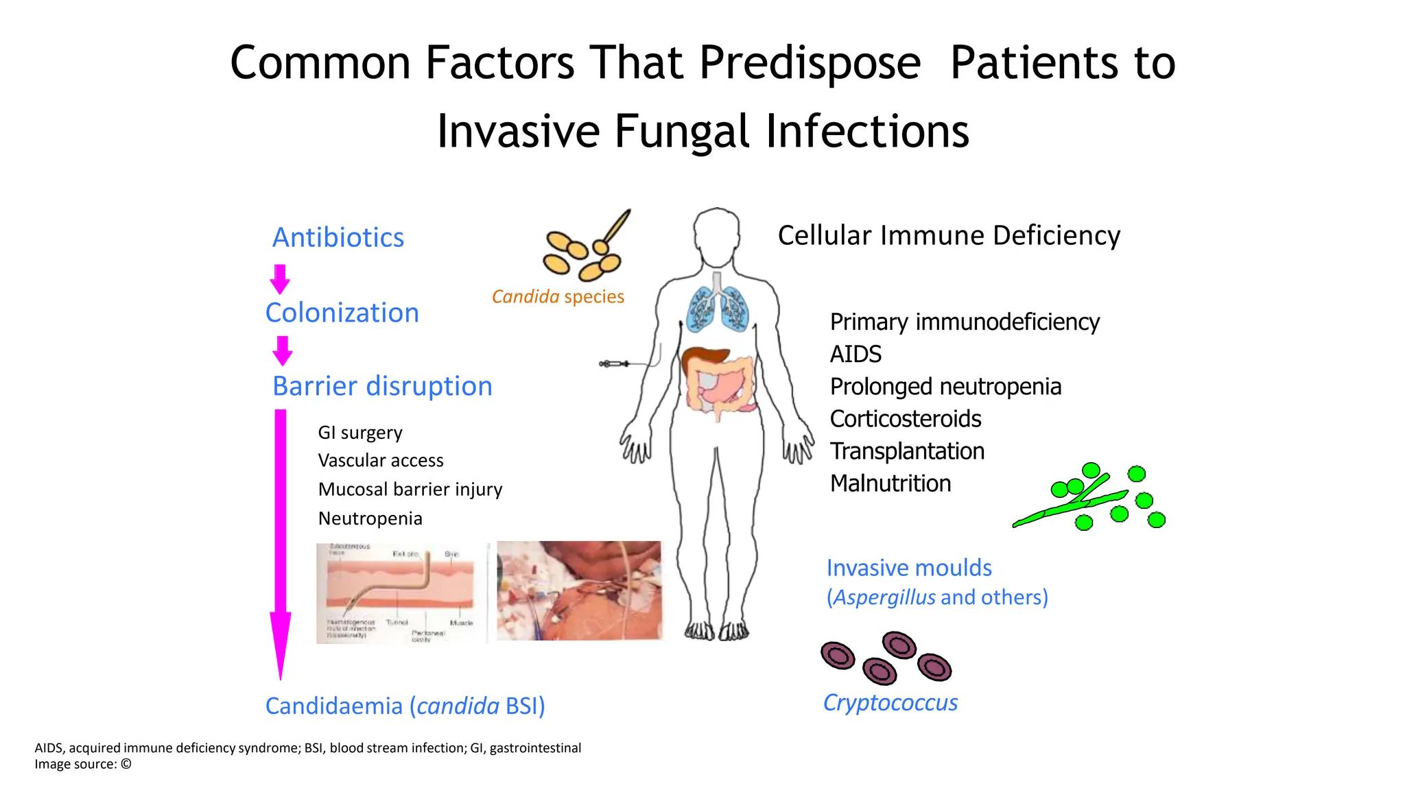 Management of Fungal Infection with Voriconazole Ppt.pptx