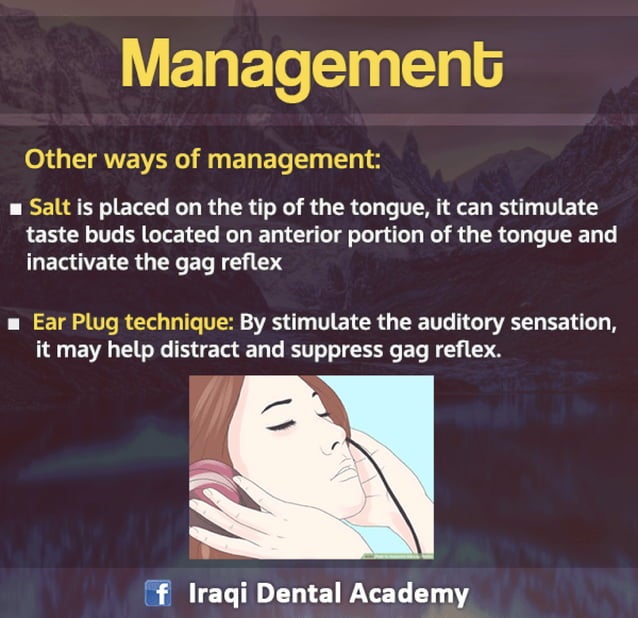Management of Gag Reflex | PDF