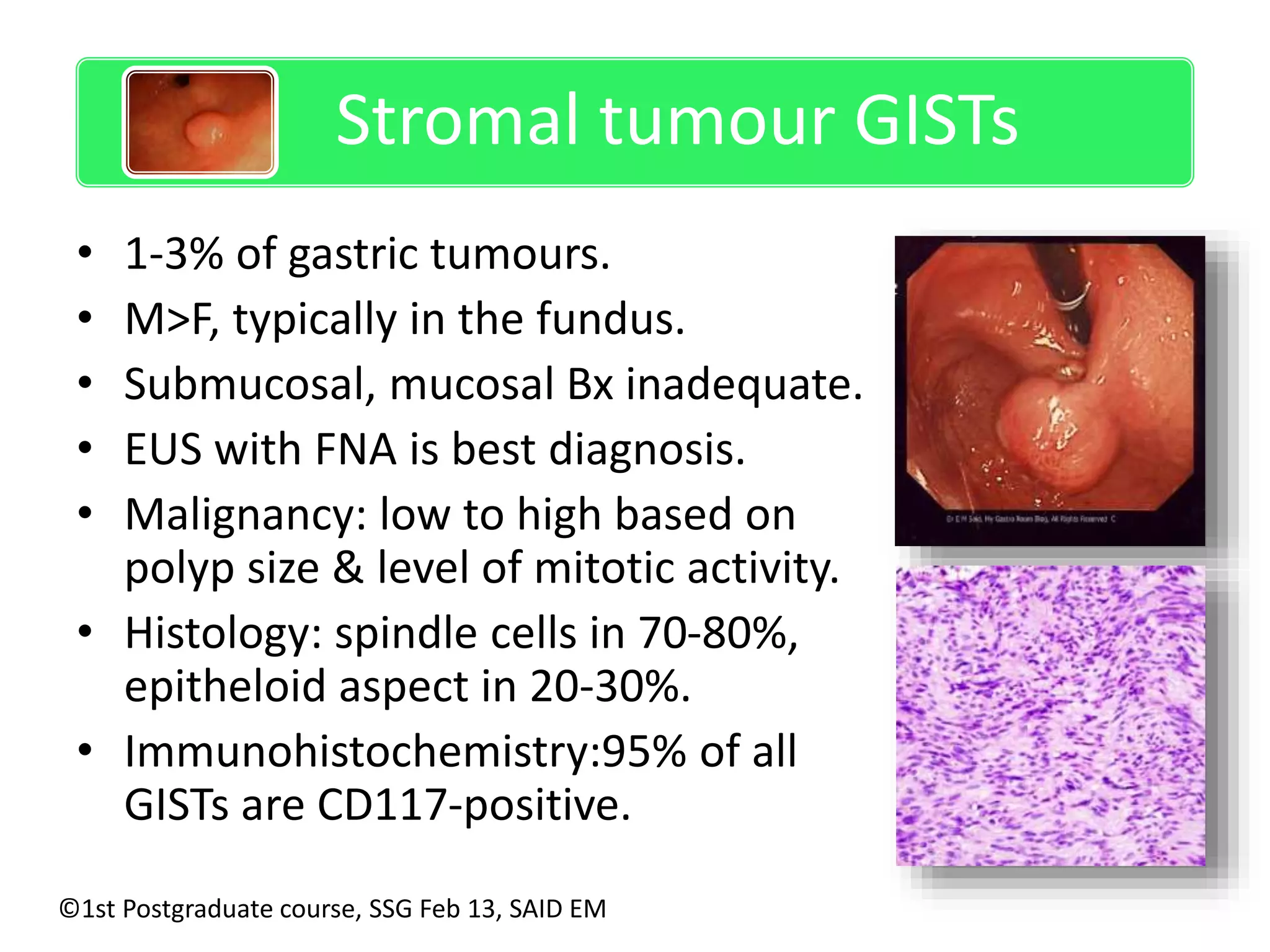 Management of gastric polyps | PPTX