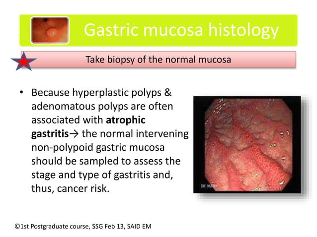 Management of gastric polyps | PPTX