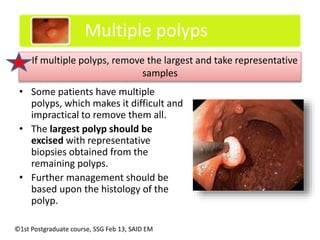 Management of gastric polyps | PPTX