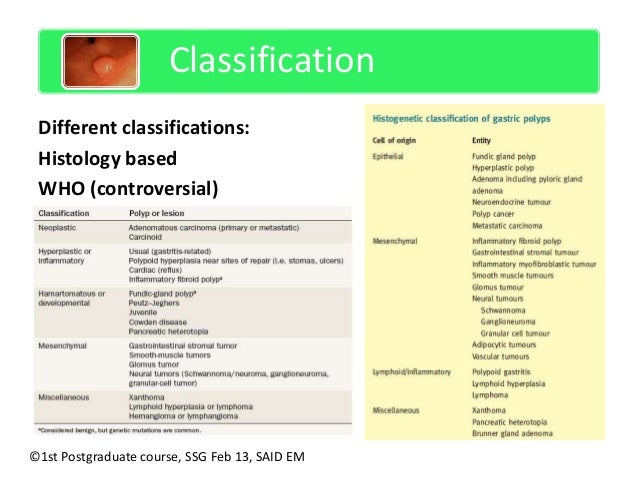 Management of gastric polyps