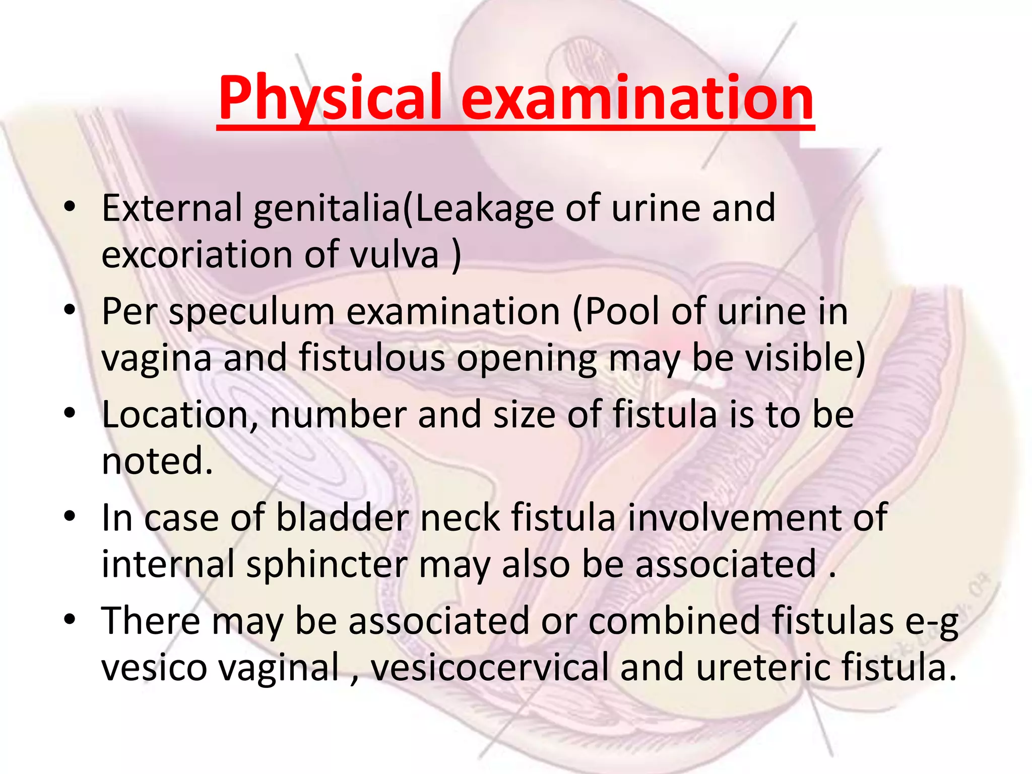 Management of genitourinary fistula | PPTX