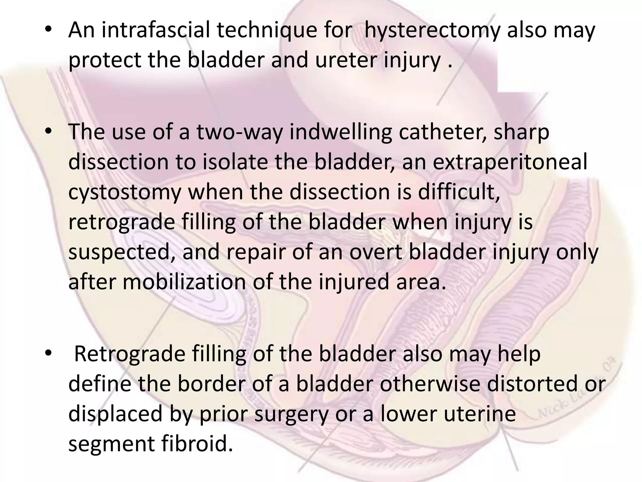 Management of genitourinary fistula | PPTX