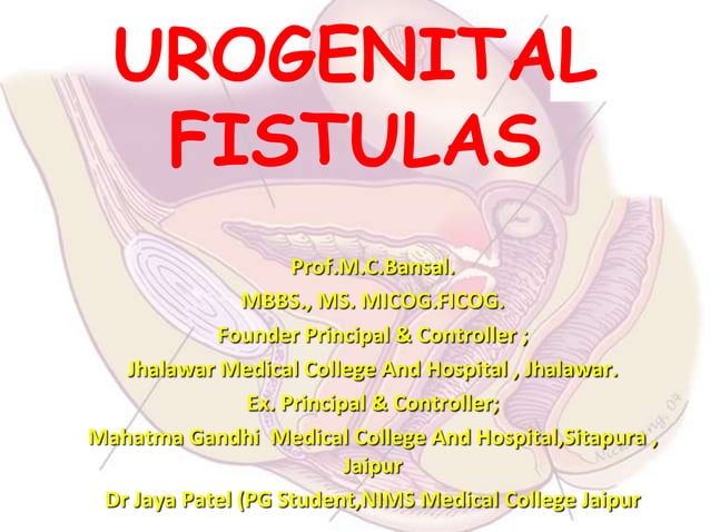 Management of genitourinary fistula | PPTX