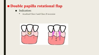 MANAGEMENT OF GINGIVAL RECESSION BY DR.HEMRAJ PANDIT.pptx