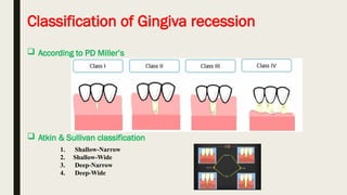 MANAGEMENT OF GINGIVAL RECESSION BY DR.HEMRAJ PANDIT.pptx