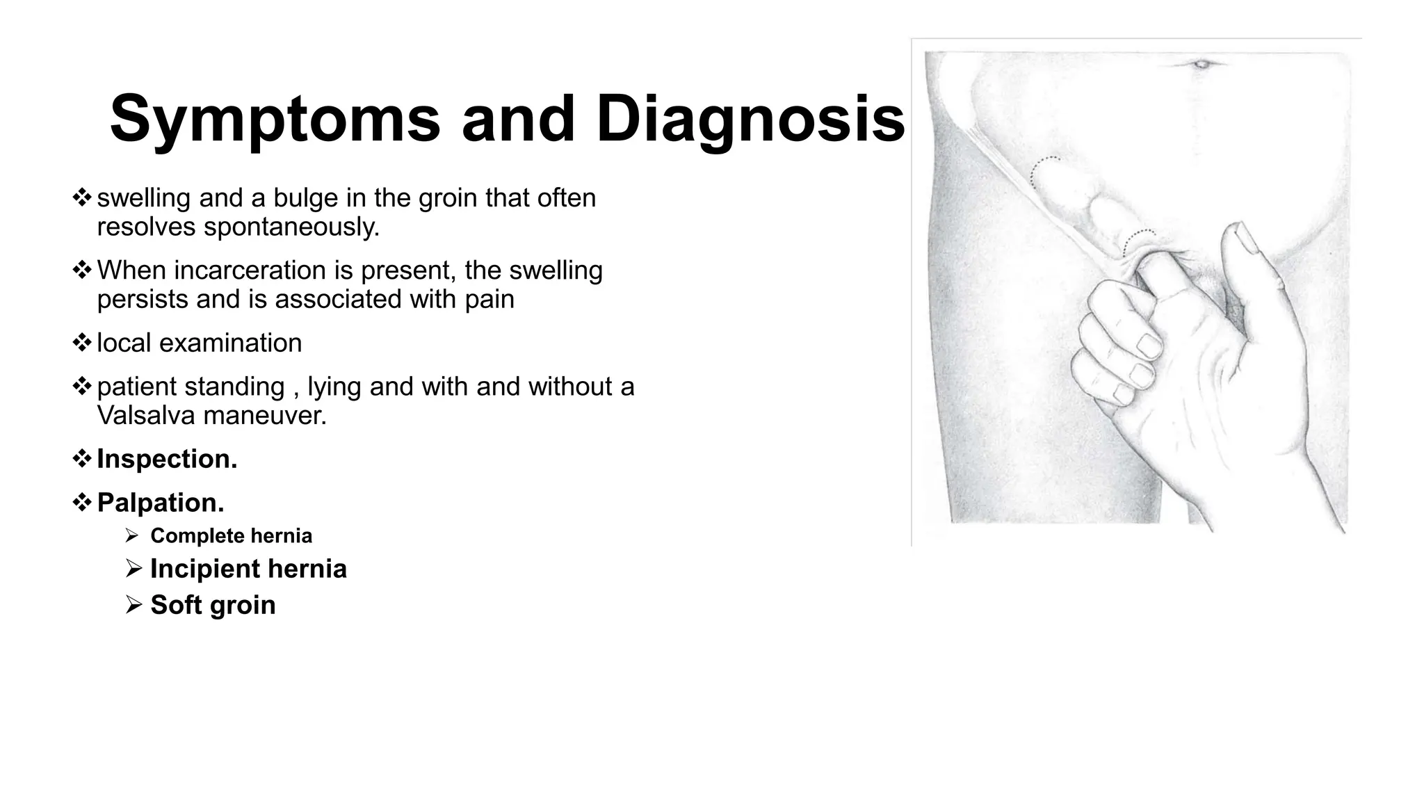 Management of Groin and Abdominal Wall Hernias.pptx