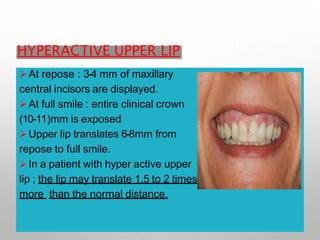 MANAGEMENT OF GUMMY SMILE – A GOLDEN WAY.pptx