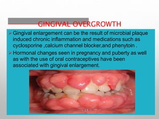 MANAGEMENT OF GUMMY SMILE – A GOLDEN WAY.pptx