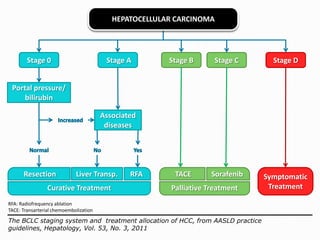 Management of HCC, an update | PPTX