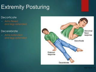 management of head trauma.ppt for medical students | PPT