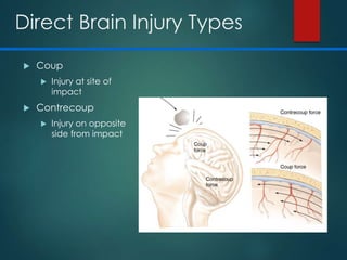 management of head trauma.ppt for medical students | PPT