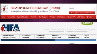 Management of hemophilia factor 8 deficiency | PPTX